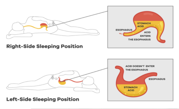 Pay Attention to Your Sleeping Position